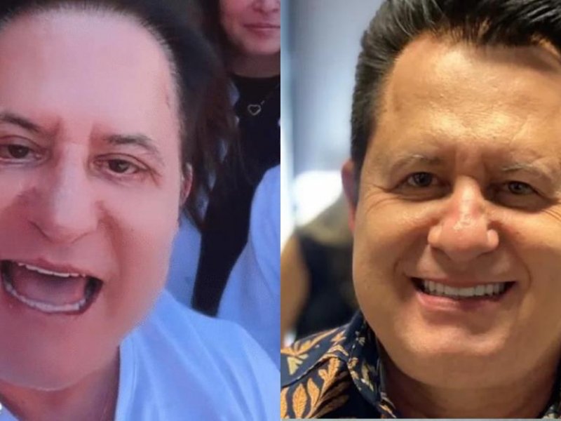 Marrone faz harmonização facial e divide opiniões